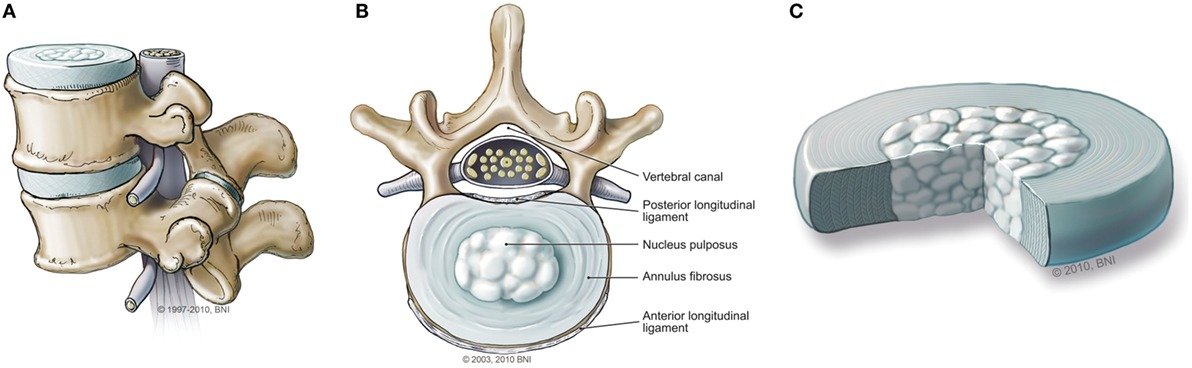 Intervertebral Disc Definition And Function - Profphysio